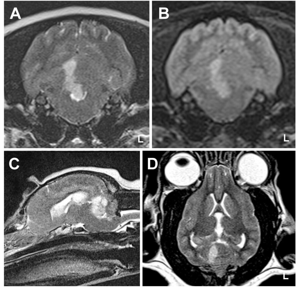 Stroke - Movement Referrals
