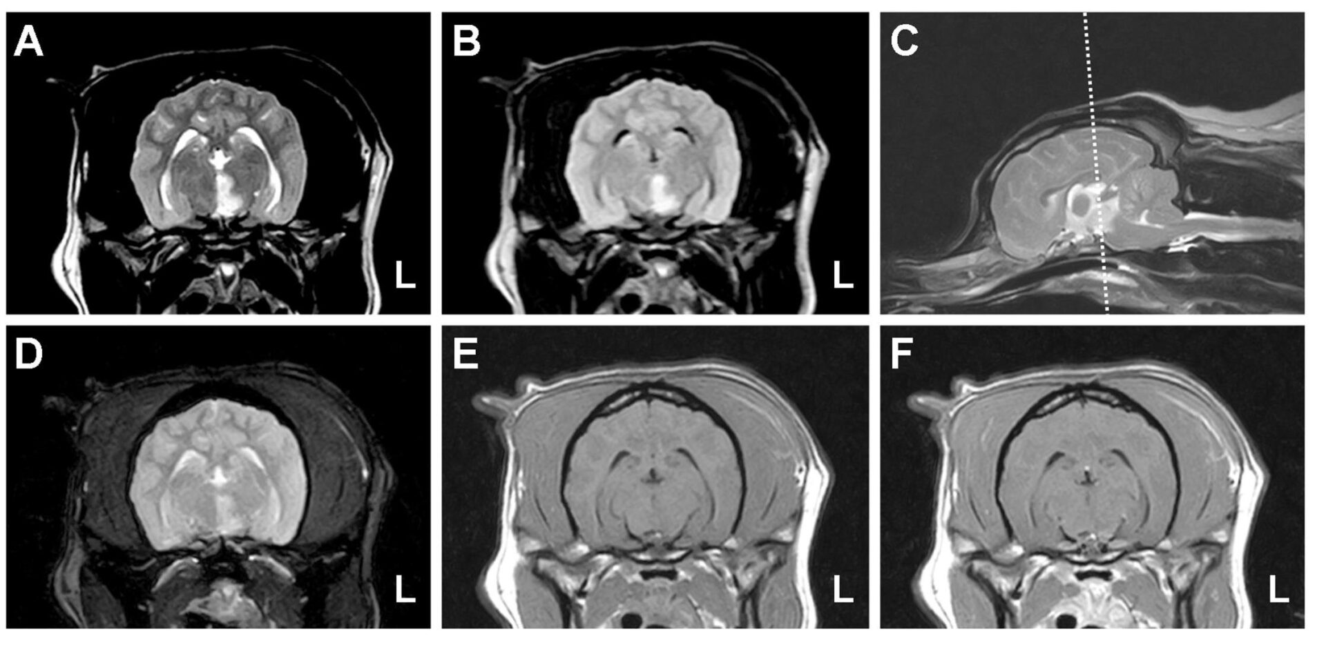 Stroke - Movement Referrals