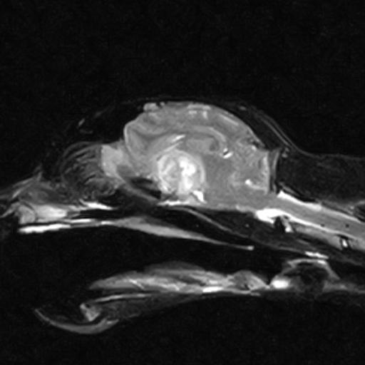 Brain Tumours - Movement Referrals