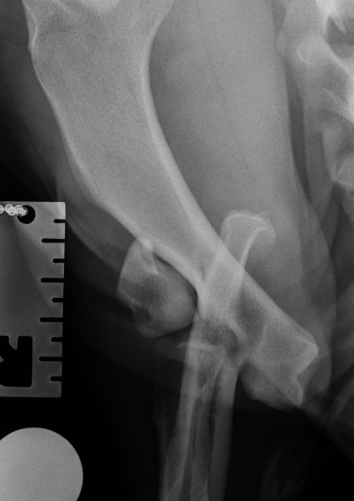 Humeral fractures - Movement Referrals