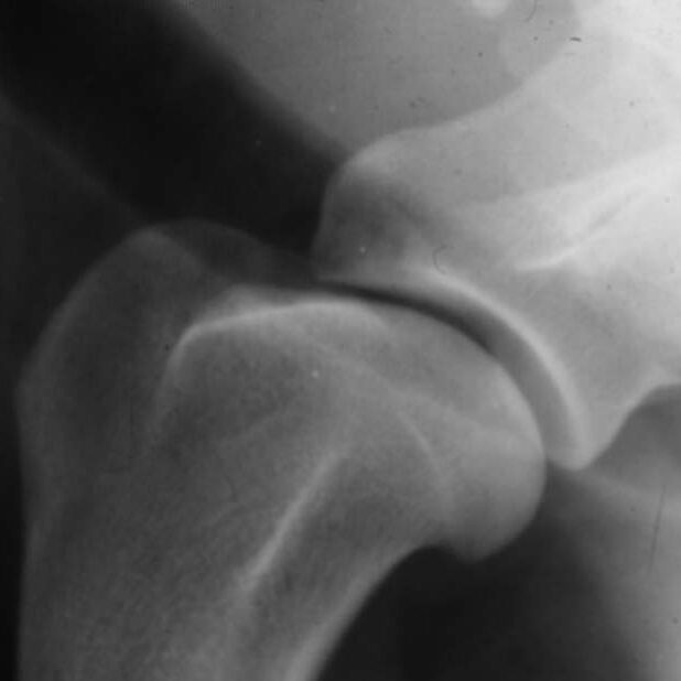 Shoulder - Movement Referrals