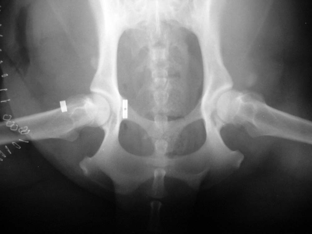 Hips - Movement Referrals