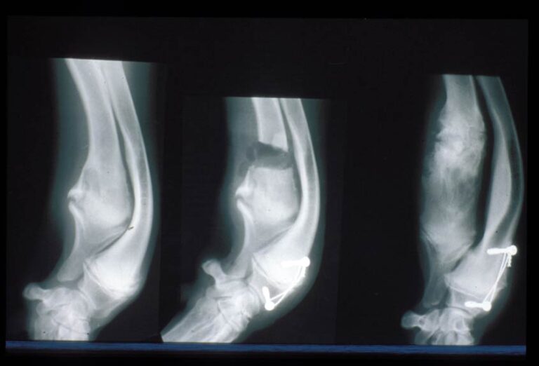 Growth Deformities - Movement Referrals