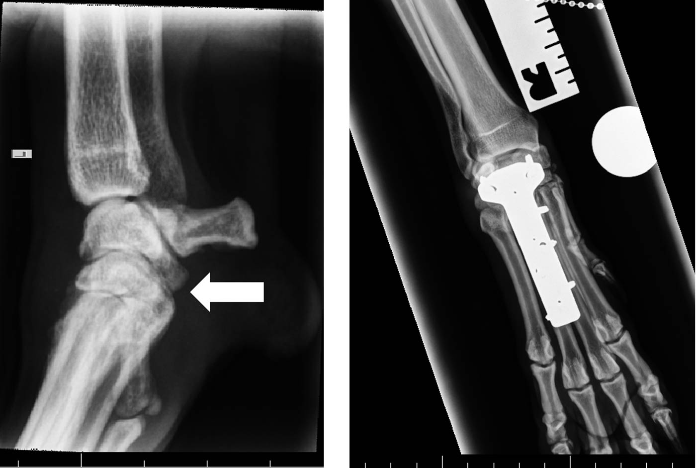 Carpus - Movement Referrals