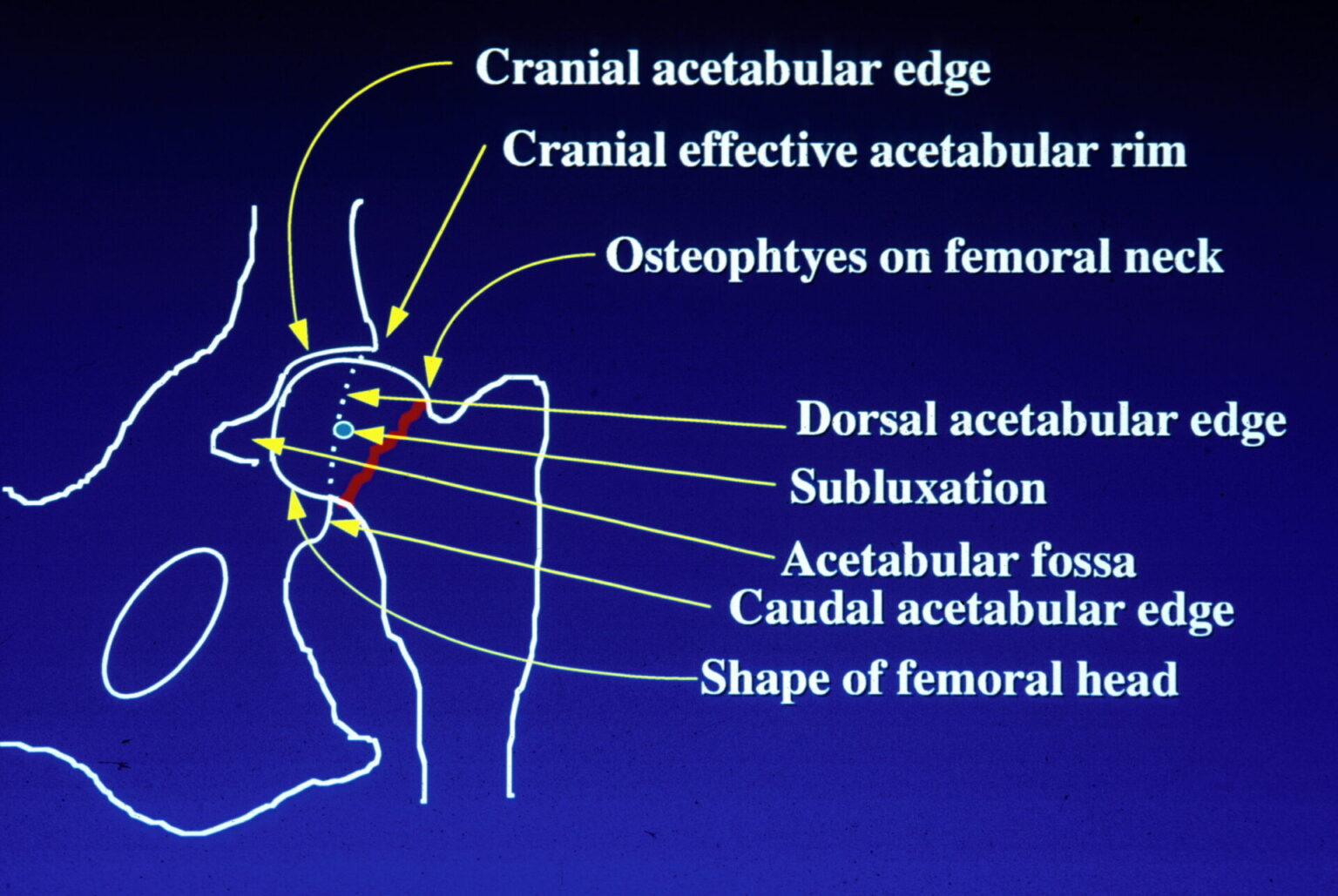 Hips - Movement Referrals