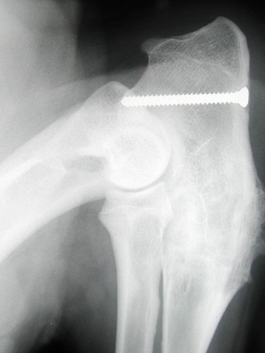 Elbow - Movement Referrals