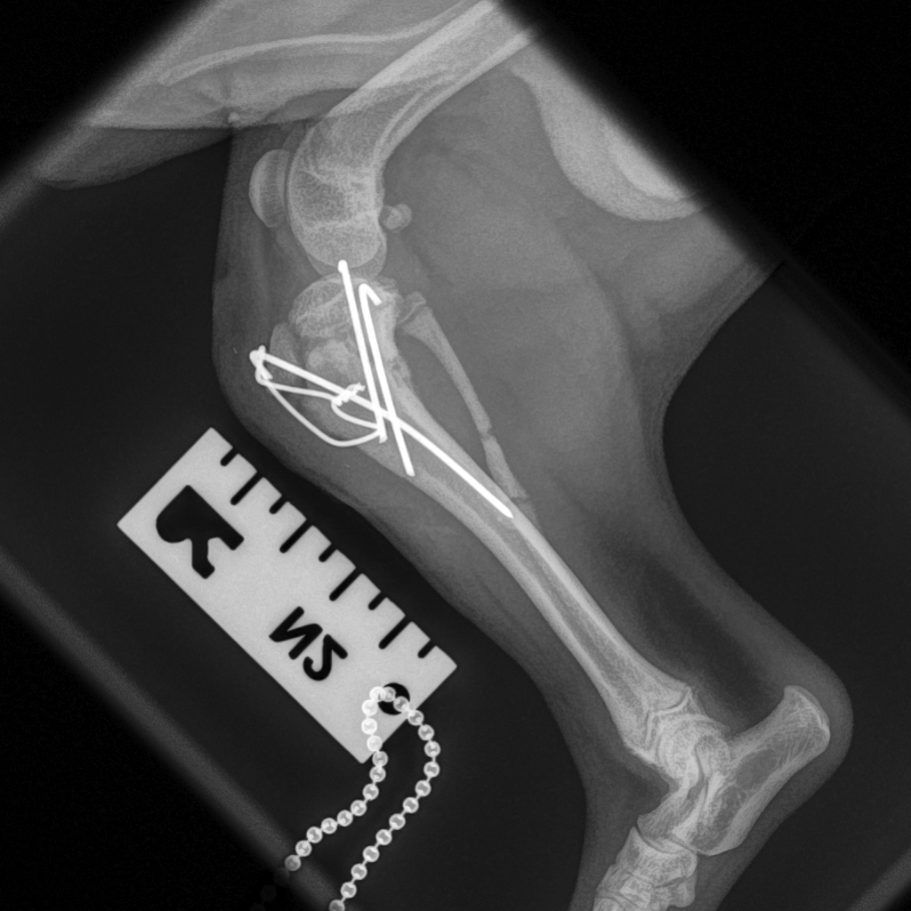 Fractures - Movement Referrals
