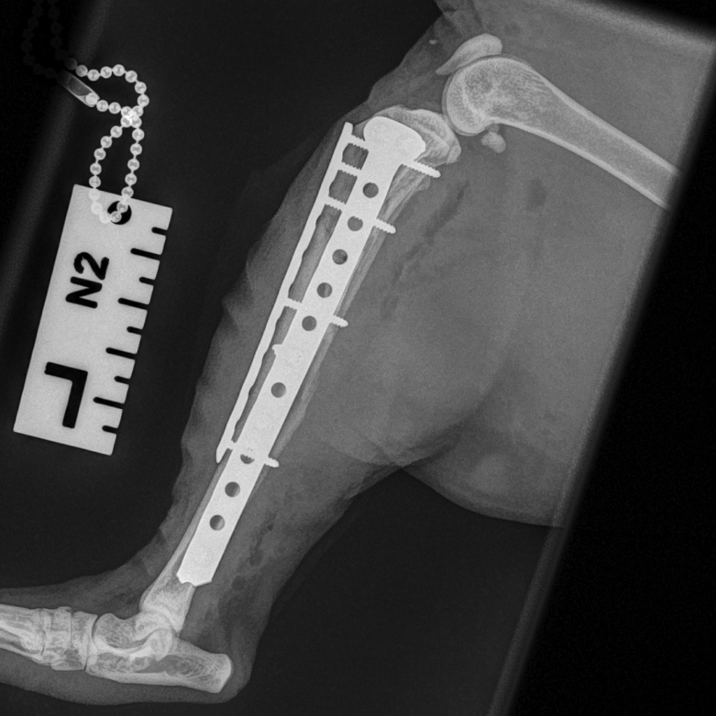 Fractures - Movement Referrals
